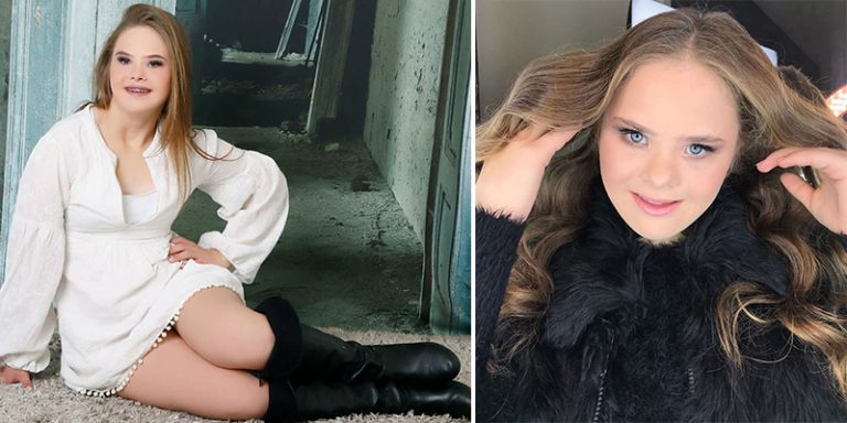 Down's Syndrome Model – Inspiring Girl on a Road to Success and Fame